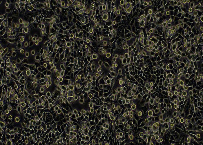 小鼠乳腺癌细胞 ; E0771_金少源(上海)生物科技有限公司-金少源(上海)生物科技有限公司